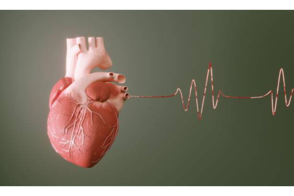 Ateroscleroza - Cardio Clinic